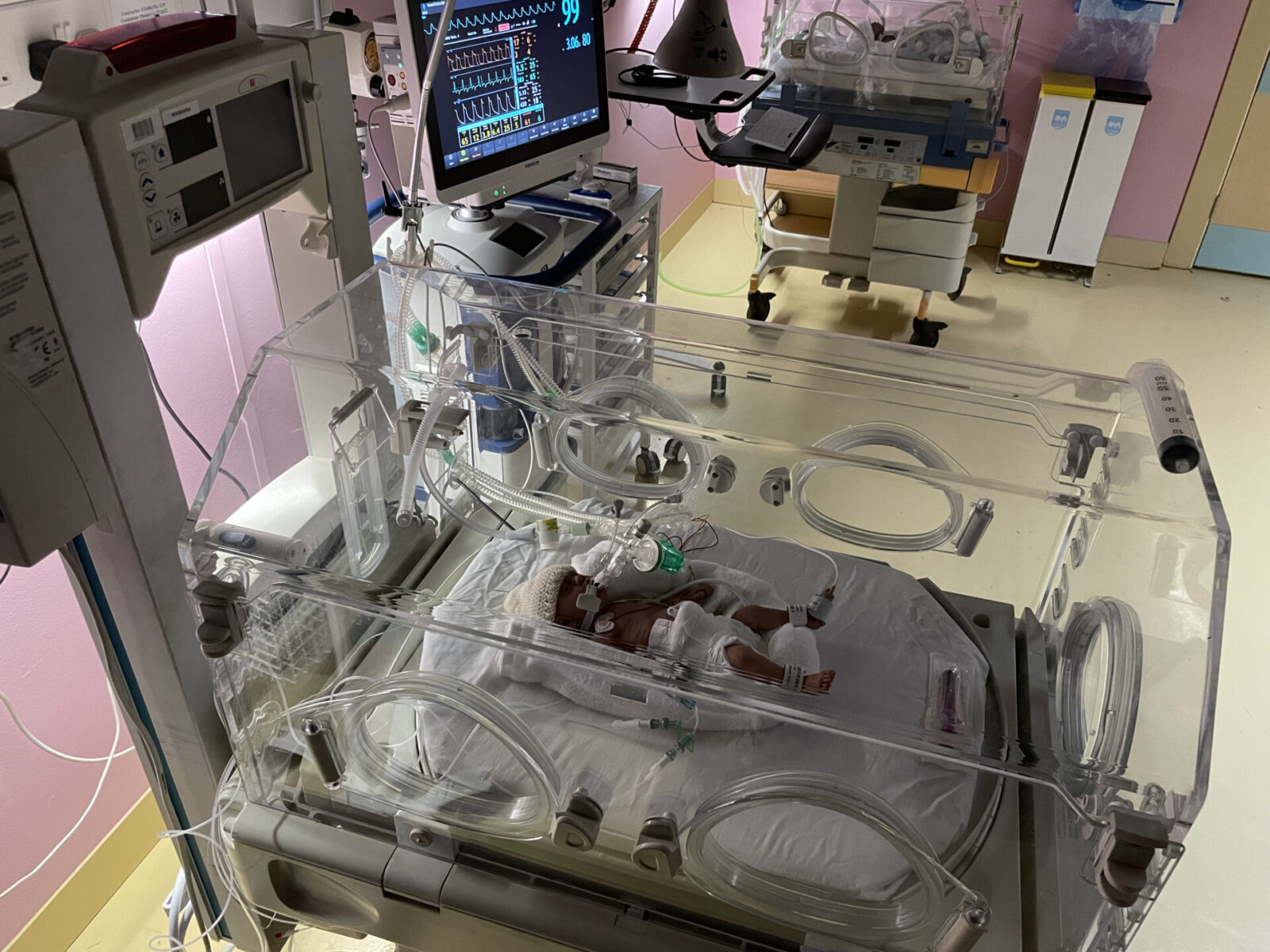 Neo-Natal Intensive Care (NICU) - Mediscene
