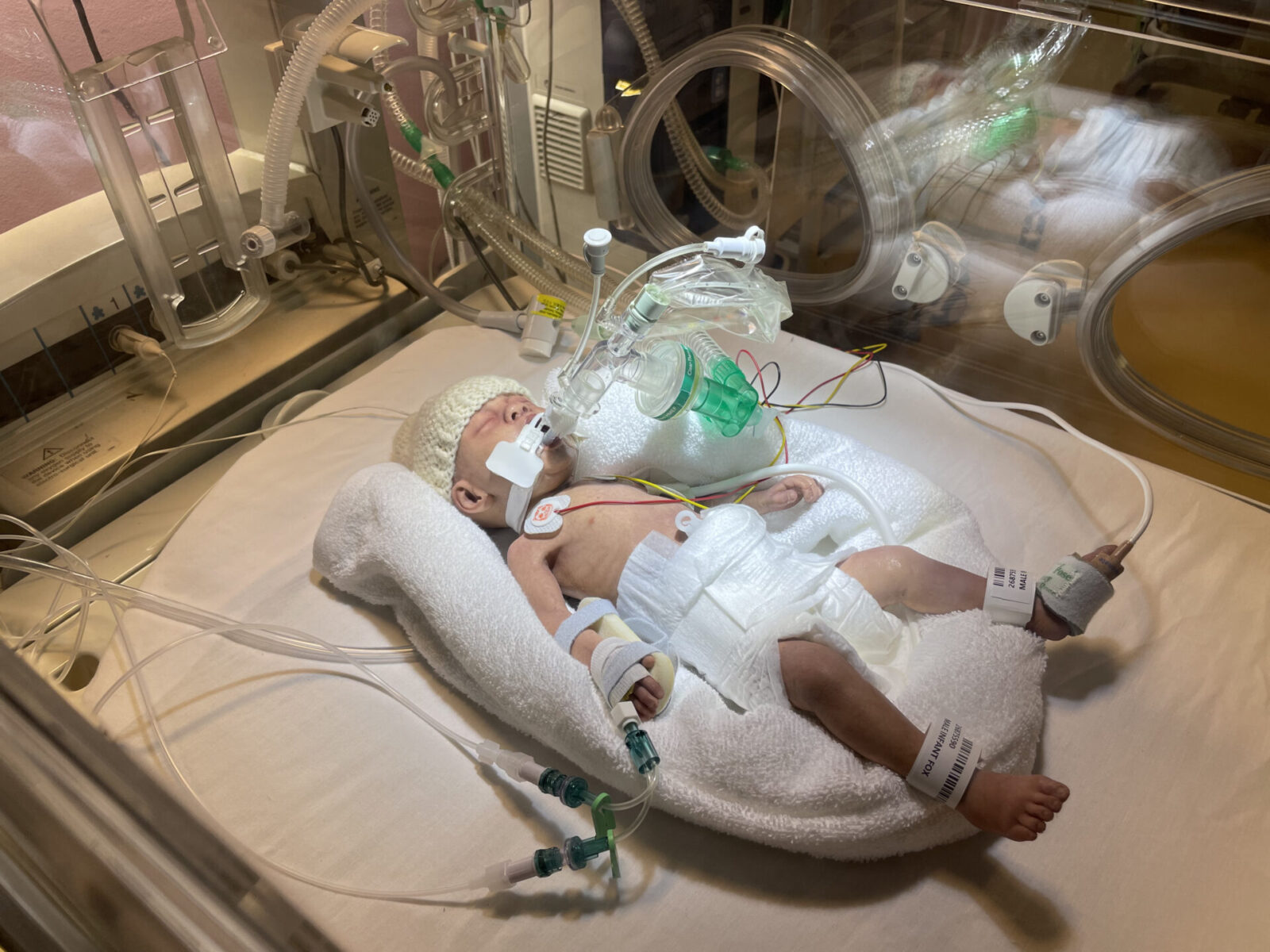 Hospital film and TV set simulations and medical prop hire