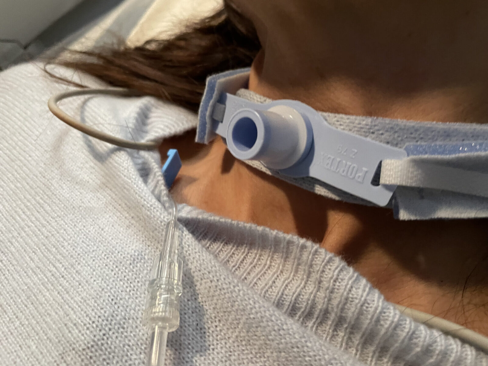 Intensive Care Units (ICU) - Mediscene